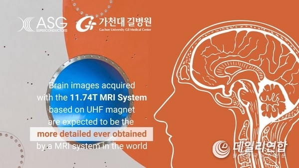 인체용 최고 혁신적인 11.74T MRI 핵심부품 마그넷 가동